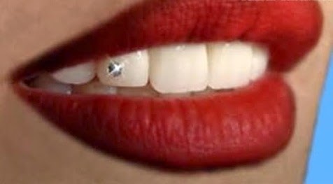 Idyll Dental: Start the Season with a Sparkle! Swarovsky Crystals make ...