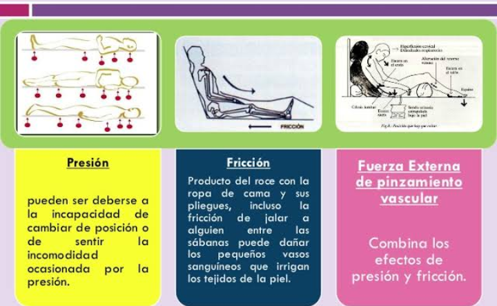Etiología de las UPP