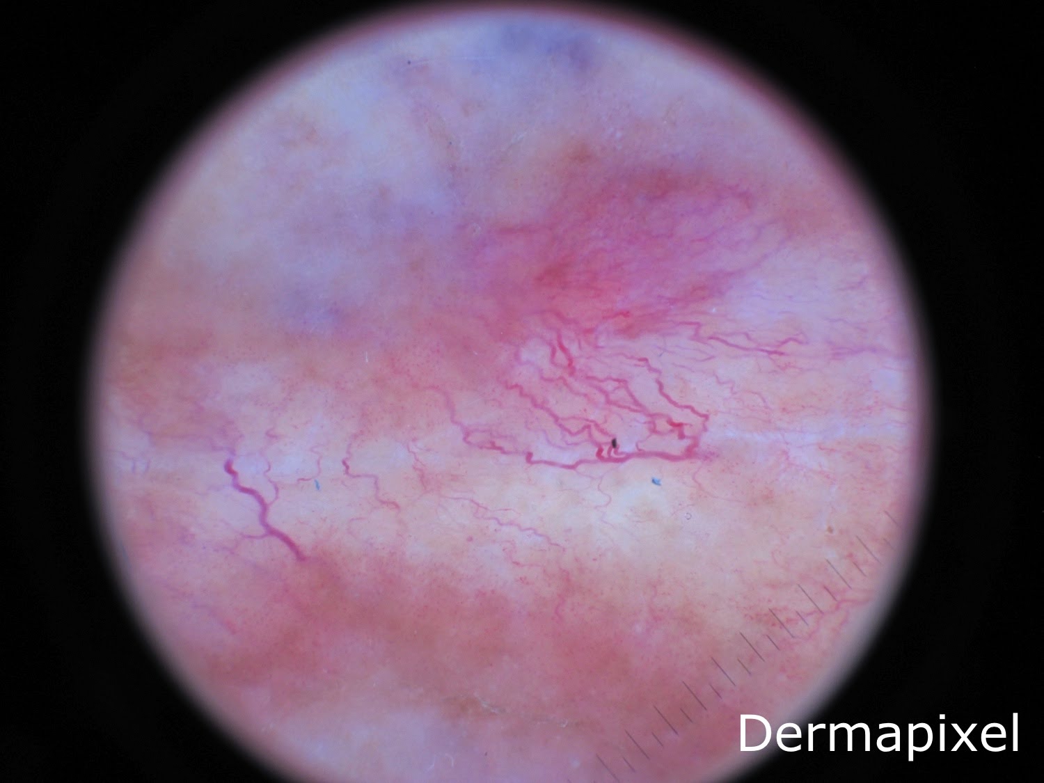 Dermapixel: enero 2018