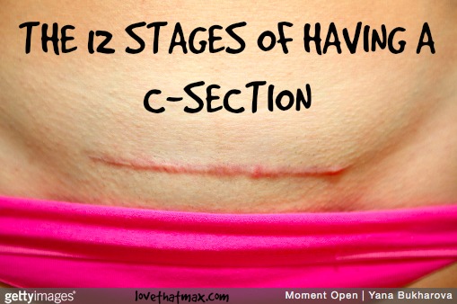 Love That Max The 12 Stages Of Having A C Section