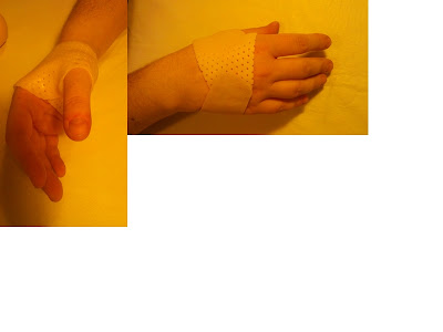 Autonomía & Función by María del Mar Vales Flores: Férulas de mano