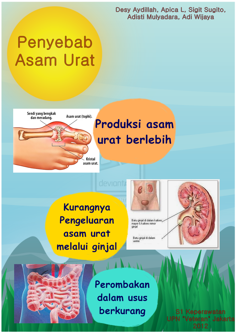 MONGGO DILIHAT: Poster Asam Urat
