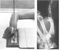 Radiologia: imagenologia 2