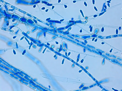 Fun With Microbiology (What's Buggin' You?): Trichophyton tonsurans