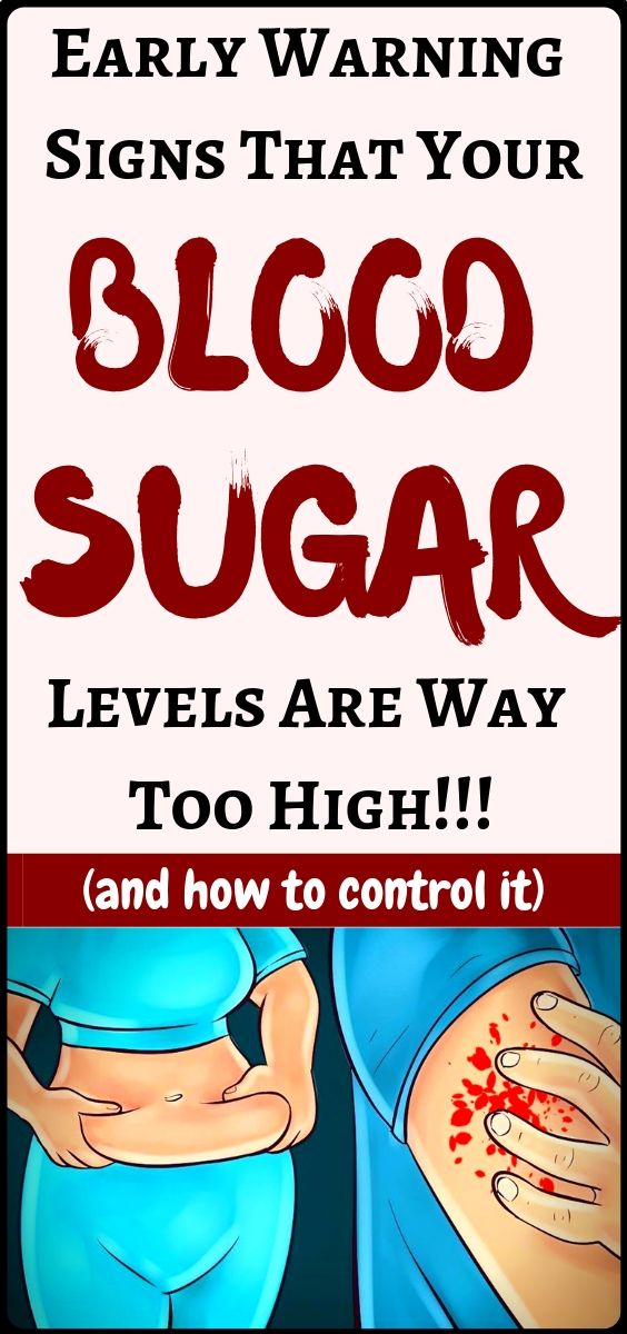 11 High Blood Sugar Signs And Symptoms To Watch Out For Healthy Amazing