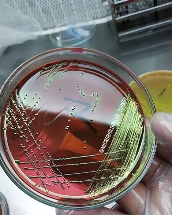 Eosin Methylene Blue Emb Agar Microbiology Laboratory Turkey