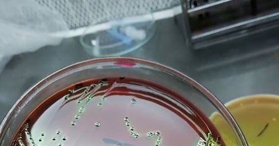 EOSIN METHYLENE BLUE (EMB) AGAR - Microbiology Laboratory Turkey