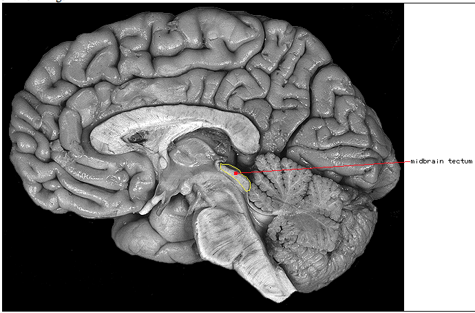 Atlas de neuroanatomía: ESTRUCTURAS DEL MESENCÉFALO