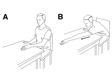 Rotator cuff repair, start to finish: Excitement and surprise.