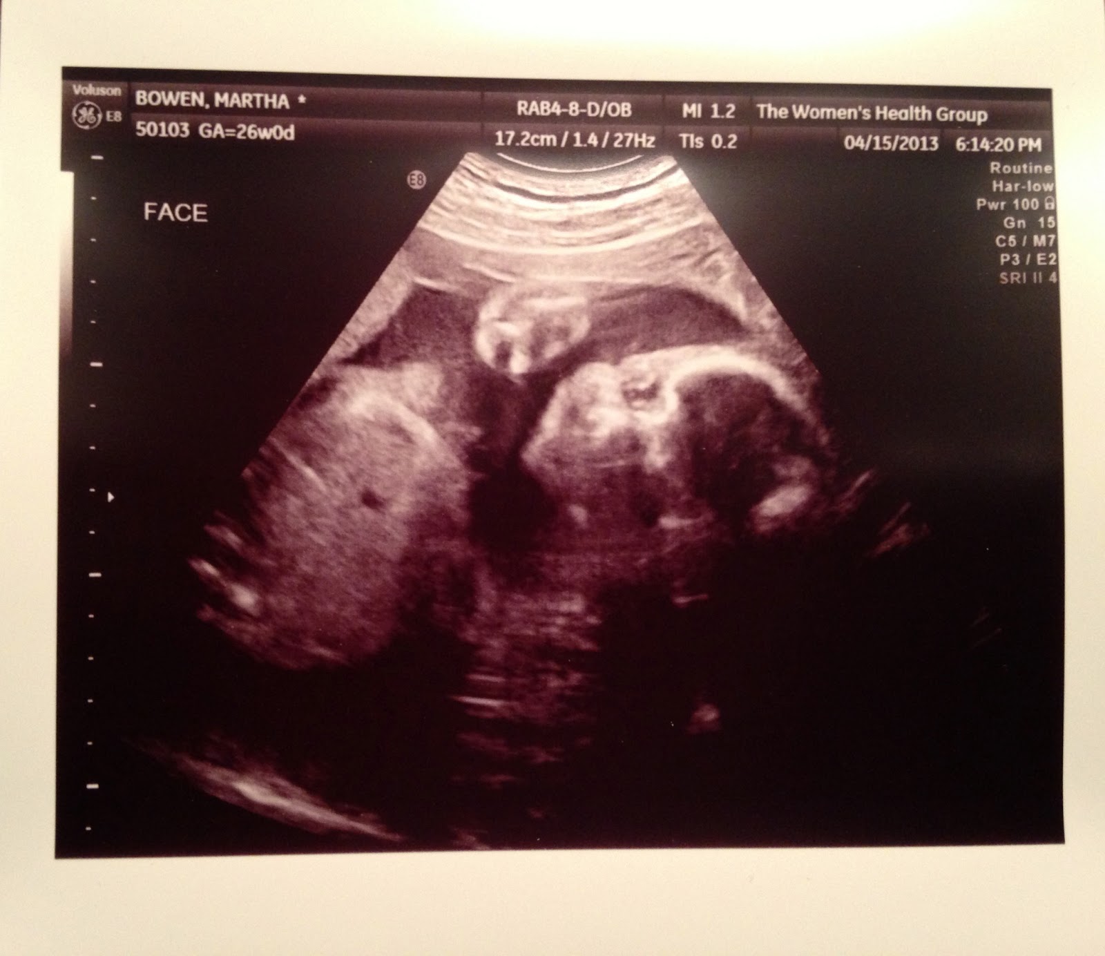 Mama Martha: 26 weeks - Childbirth class and ultrasound!