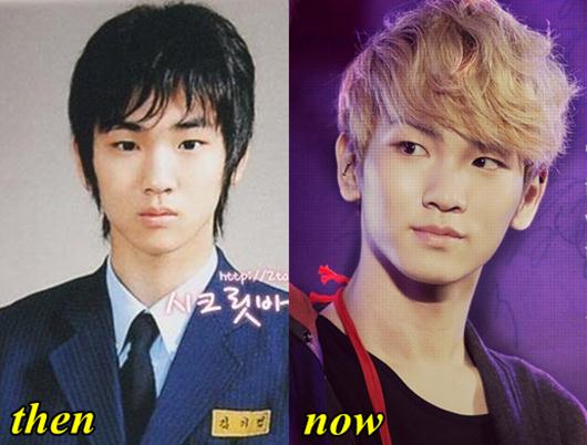 Kpop Star Shinee Key Plastic Surgery Before and After | Kpop Plastic ...