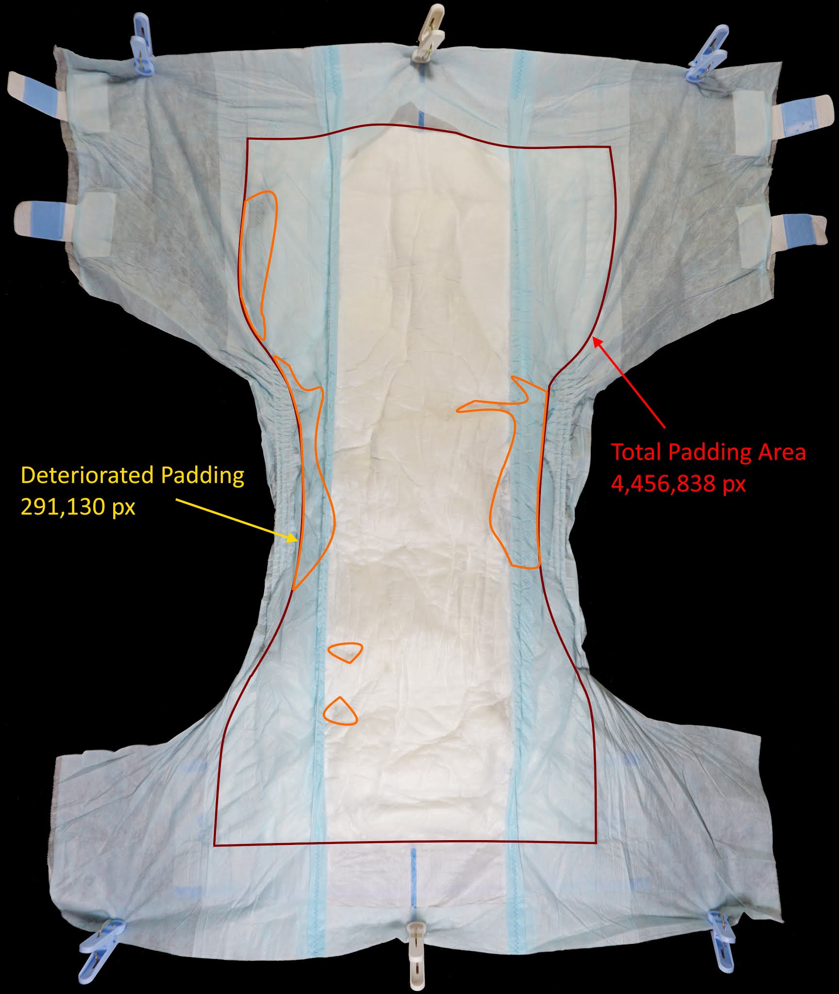 Diaper Metrics: Attento Tape-Style Adult Diaper Review