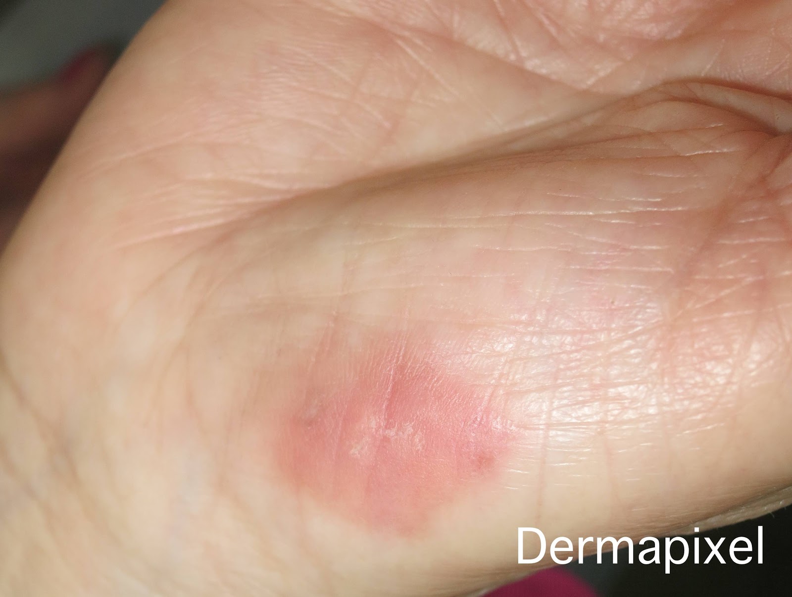 Dermapixel: abril 2020