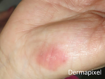 Dermapixel: abril 2020