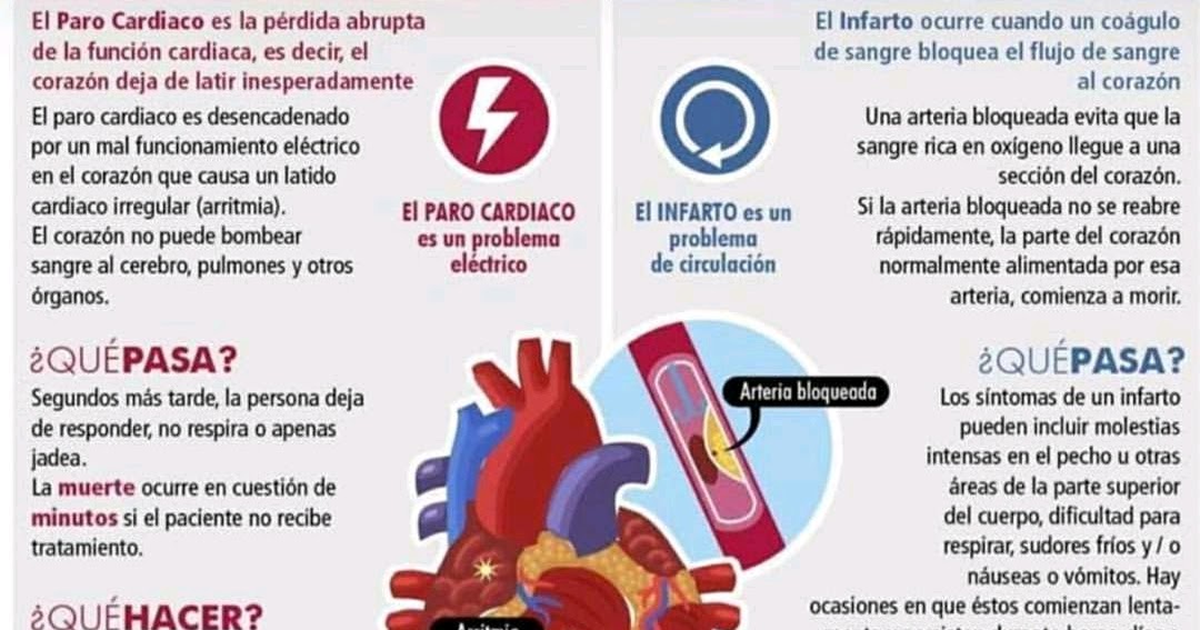 PARO CARDIACO VS INFARTO