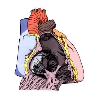 Ventricule droit | Maison de medecine