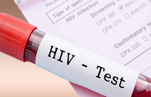 List Of HIV Testing Centers In Bohol Pilipinas ph list-of-hiv-testing-centers-in-bohol-pilipinas-ph