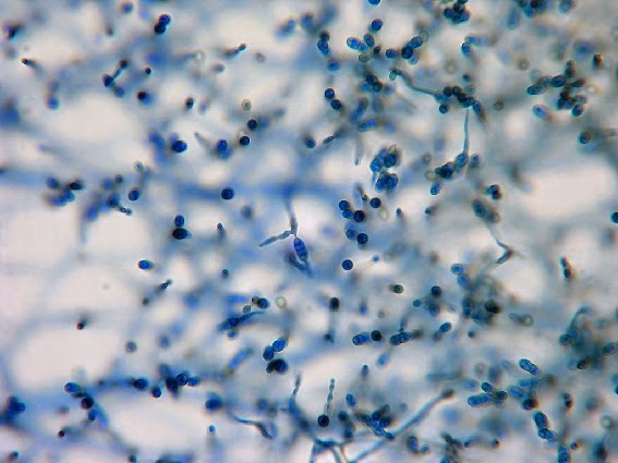 Fun With Microbiology (What's Buggin' You?): Ochroconis species