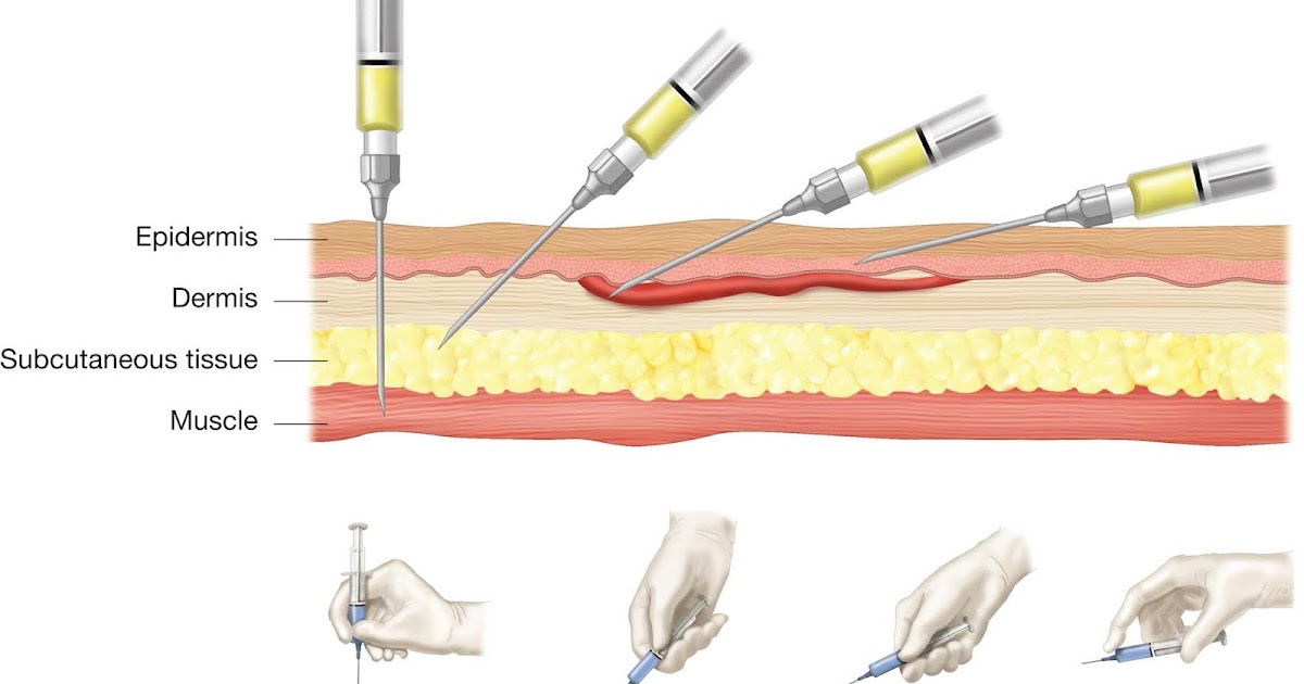 Administration of Injectable Medications - Medical Yukti