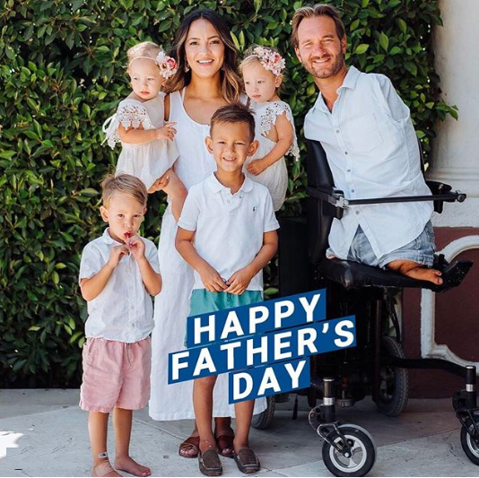 Baby born without arms and legs in India leaves doctors puzzled - Where ...