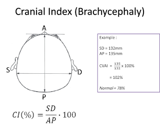 Using craniometer