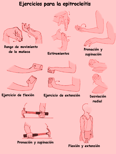 Ci-ortra: EPITROCLEITIS