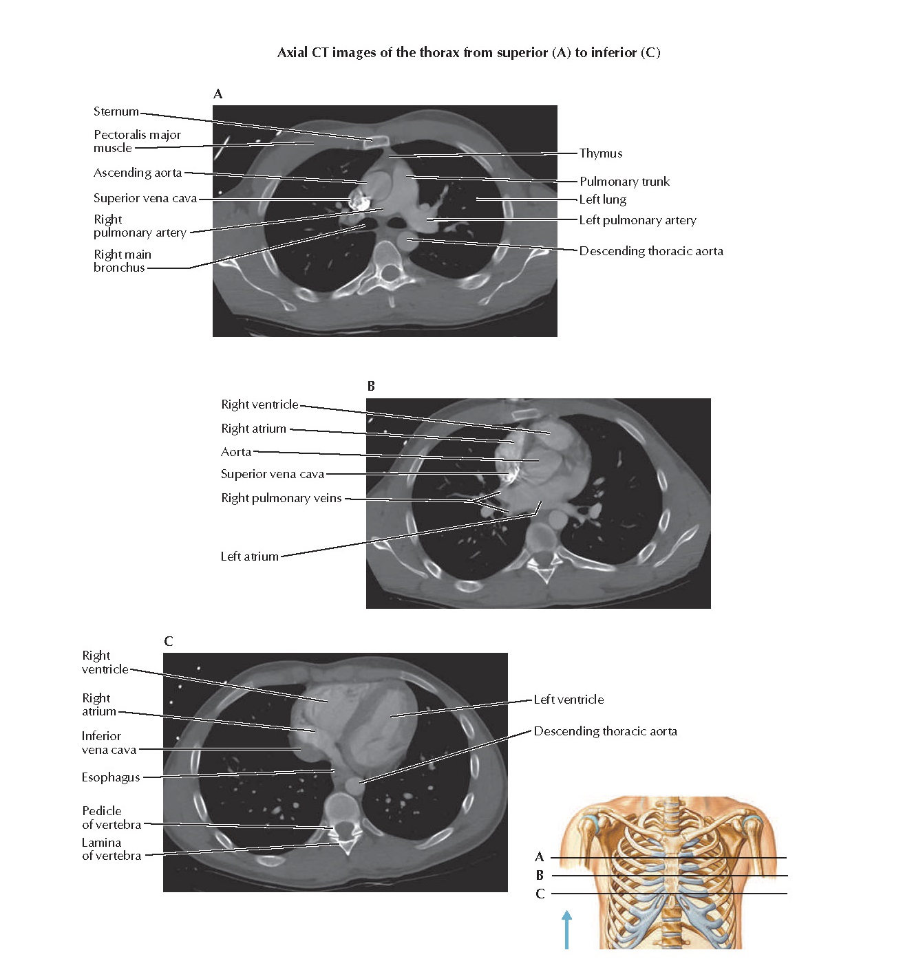 Chest Scans: Axial CT Images Anatomy - pediagenosis