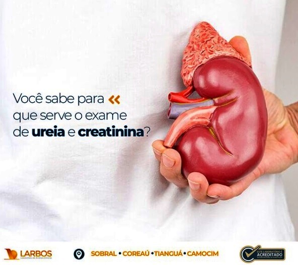 CAMOCIM POLÍCIA 24h: VOCÊ SABE PARA QUE SERVE O EXAME DE UREIA E ...