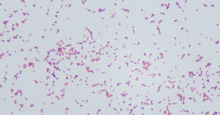 Granulicatella adiacens