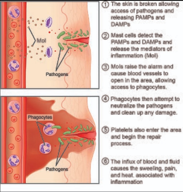 Mekanisme Reaksi Inflamasi Atau Peradangan - Repro Note