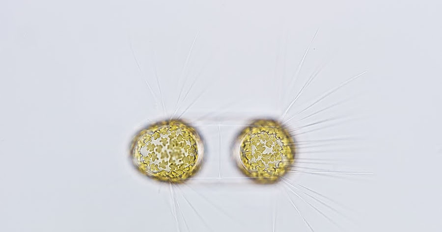 明石・神戸の虫 ときどきプランクトン2: カサボネケイソ ウ Corethron criophilum