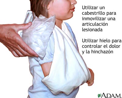 tusquebraduras: Fracturas y Quebraduras