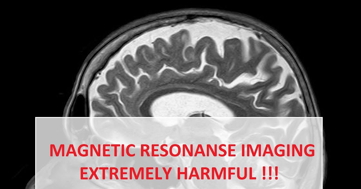 MRI (MAGNETIC RESONANCE IMAGING) – EXTREMELY HARMFUL | MY HEALTH LEGACY
