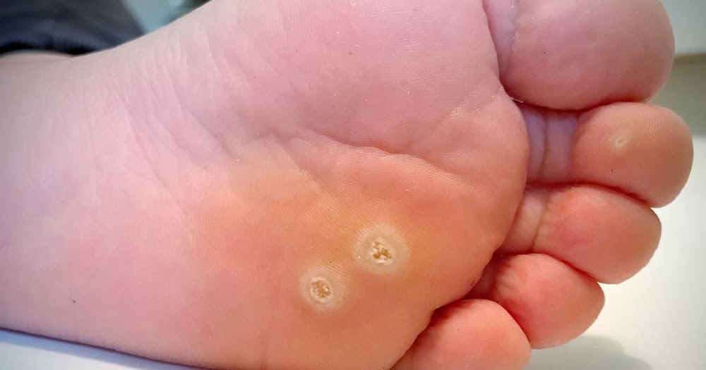 5 mistakes that make fish eyes do not heal - cungkring.com