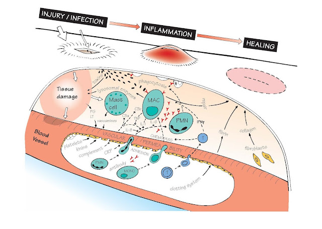 Acute Inflammation - pediagenosis