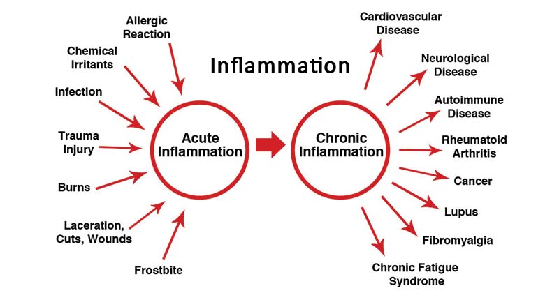Inflammation and its Types