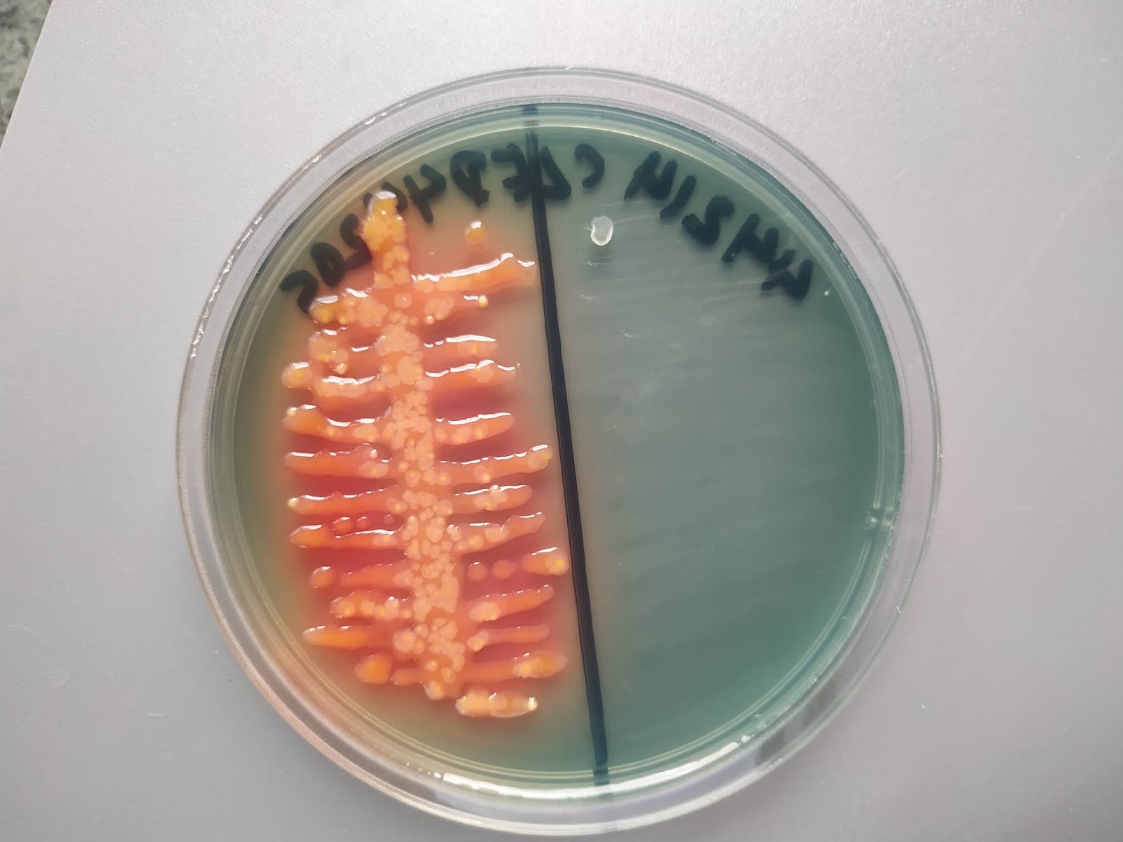MICROBIOLOGY BLOG FOR STUDENTS (MBLOGSTU): Cultural and Biochemical ...