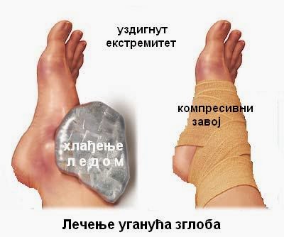 Povrede skočnog zgloba : Lečenje uganuća