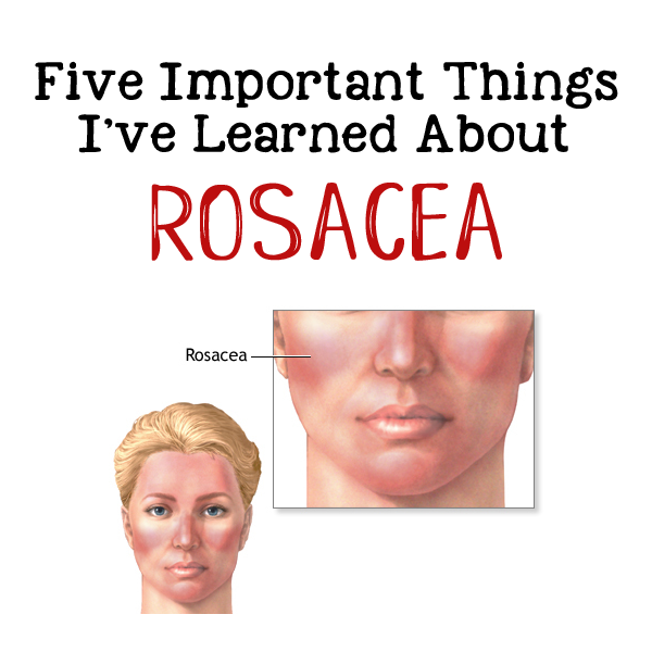 Five Important Things I've Learned About Rosacea | {enjoy the view}