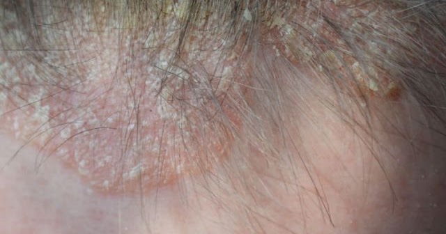 Pennsylvania Dermatology Partners, P.C. : Here’s What You Should Know ...