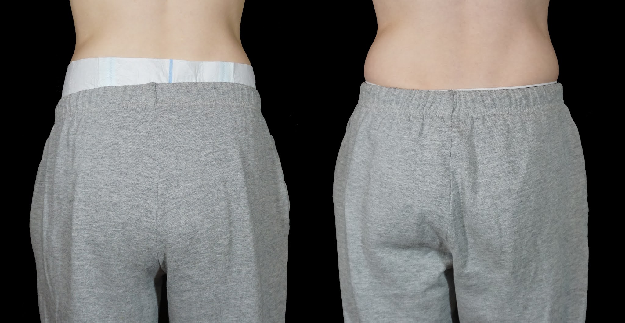 Diaper Metrics: Attento Tape-Style Adult Diaper Review