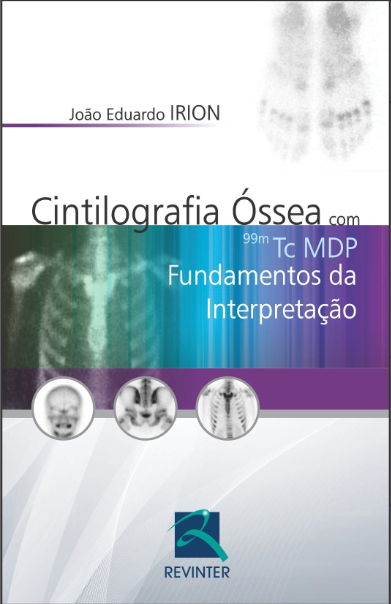 Blog Medicina Nuclear: Cintilografia Óssea com 99m Tc MDP - Fundamentos ...