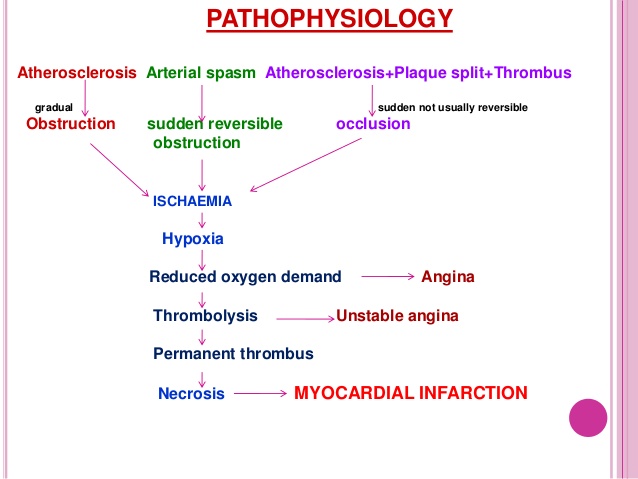 Myocardial Infarction ( Heart Attack)
