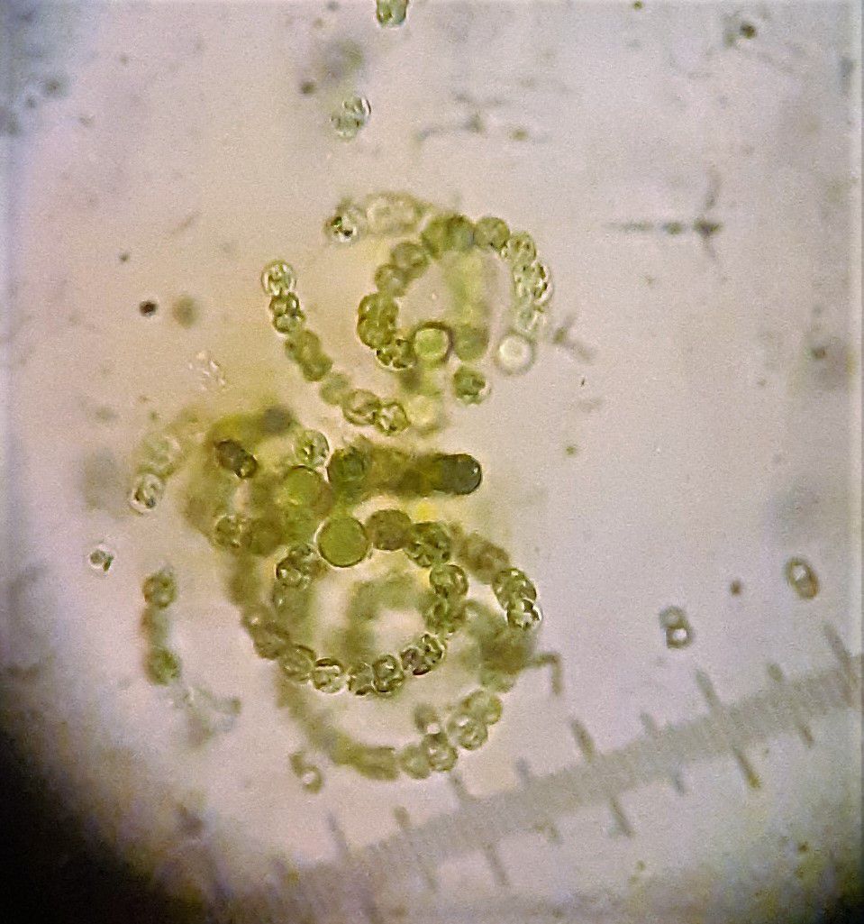 Wimbledon Park: Blue-green bacteria in the lake