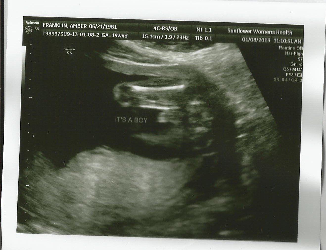 Together, we make a family.: Baby Boy Sonogram