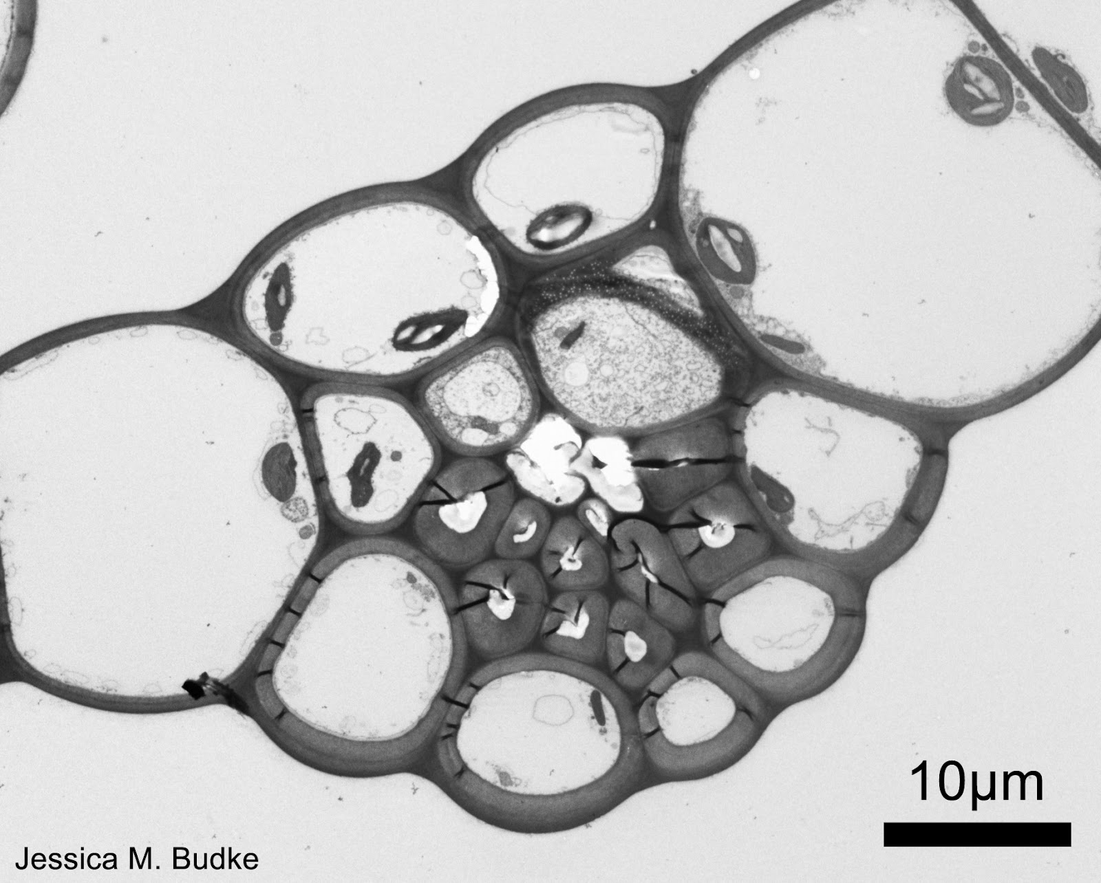 Moss Plants and More: Conducting Cells in Mosses