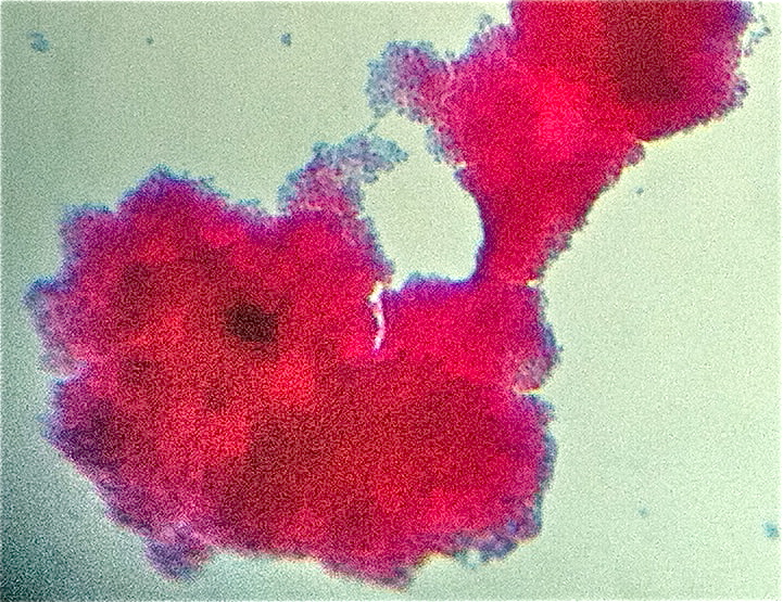 HicksMicro COURTESY Learning AID!: ACID FAST 8/22/22