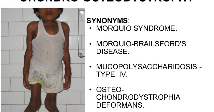 Exams And Me Morquio Syndrome