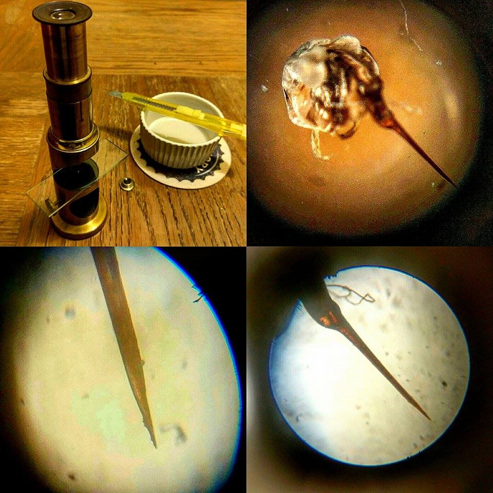 The Hivemind and Me: Bee Sting under the Microscope