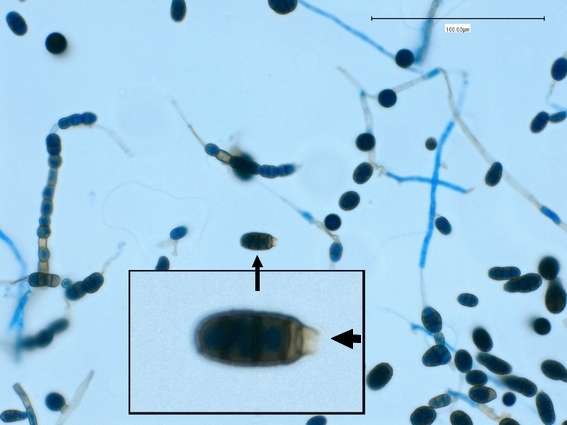 Fun With Microbiology (What's Buggin' You?): Pithomyces species
